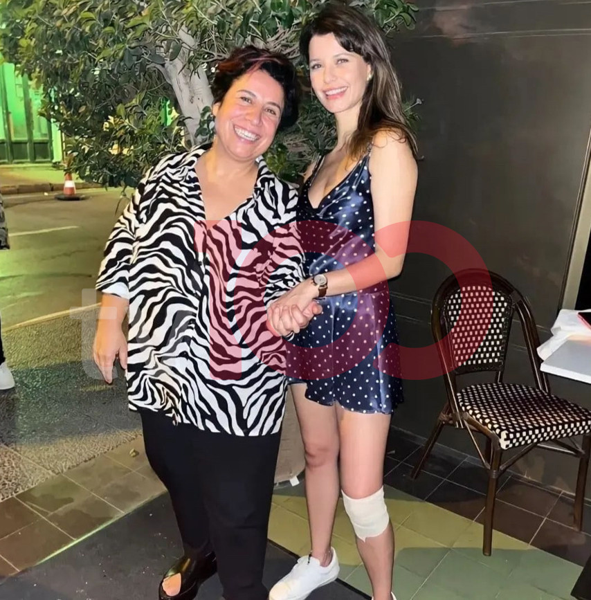 Beren Saat'in bacağına ne oldu?