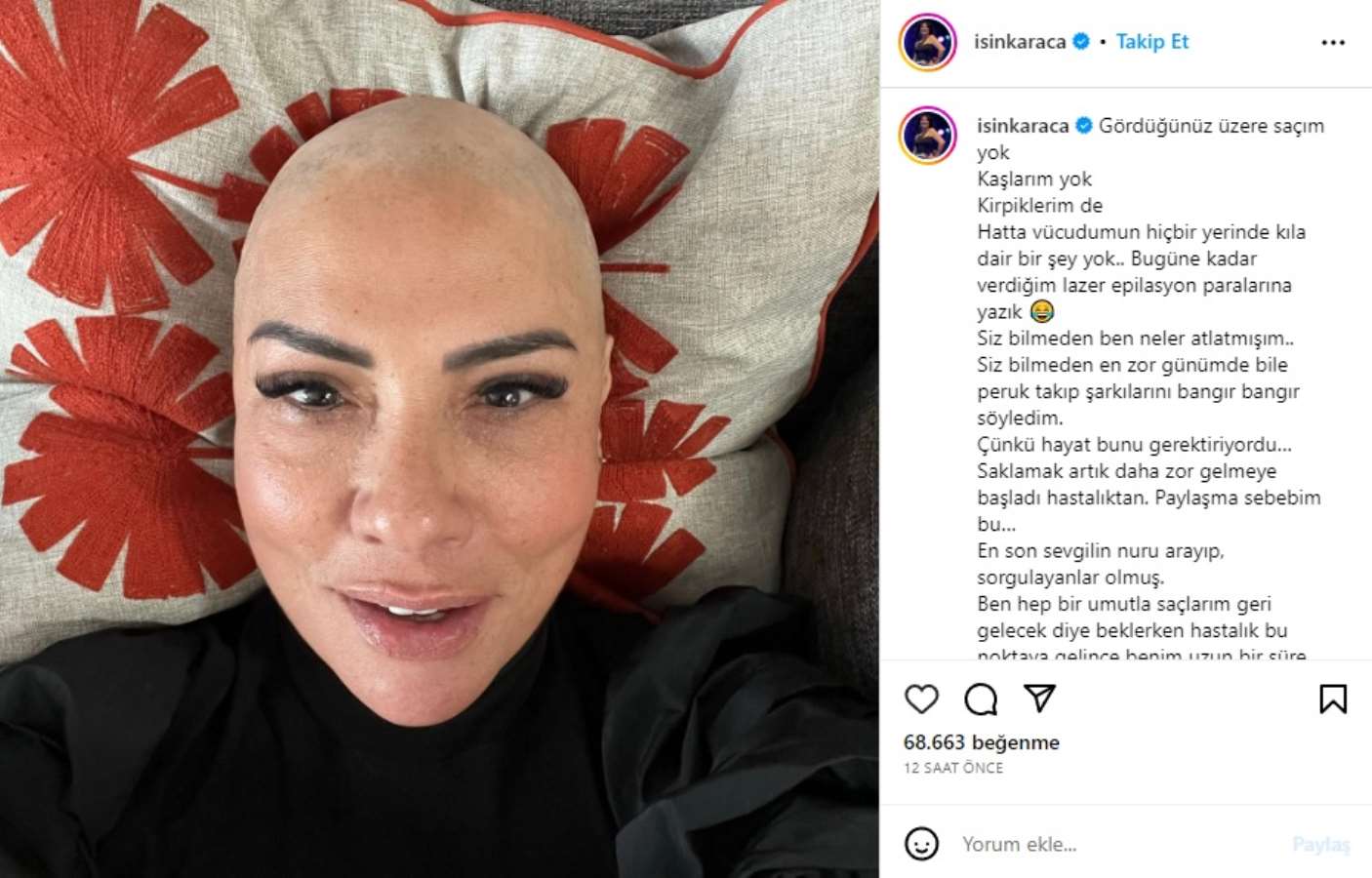 Işın Karaca hasta olduğunu duyurdu